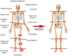 What is short leg syndrome? – Serenity Skin Care